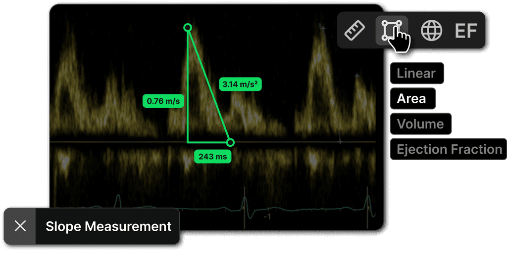 HeartLab | The Heart of Cardiac Imaging.
