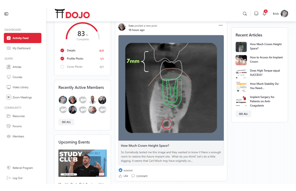 The Implant Track - Implant Ninja