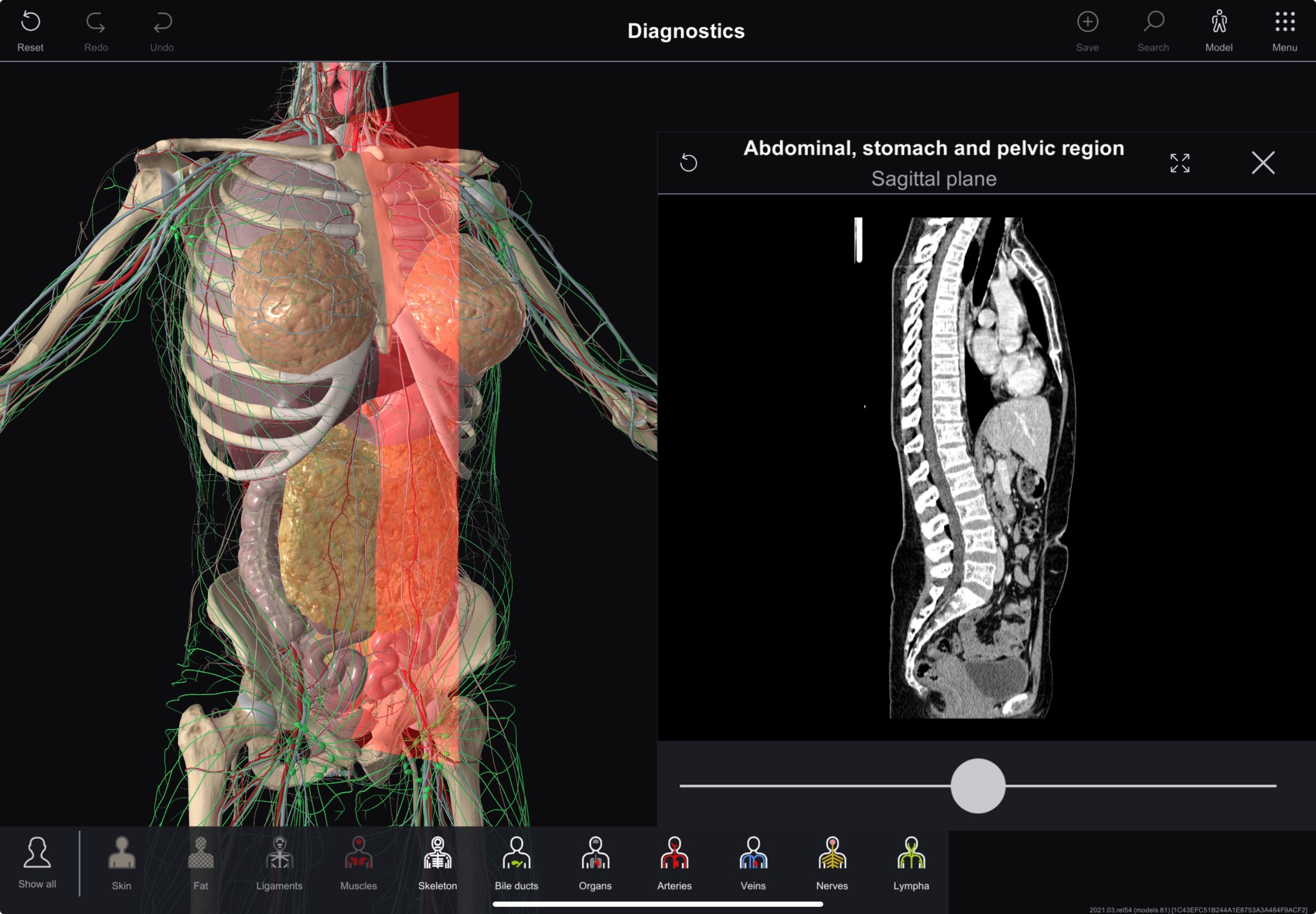 3D Anatomy Table and Digital Dissection Tables for Medical Virtual ...