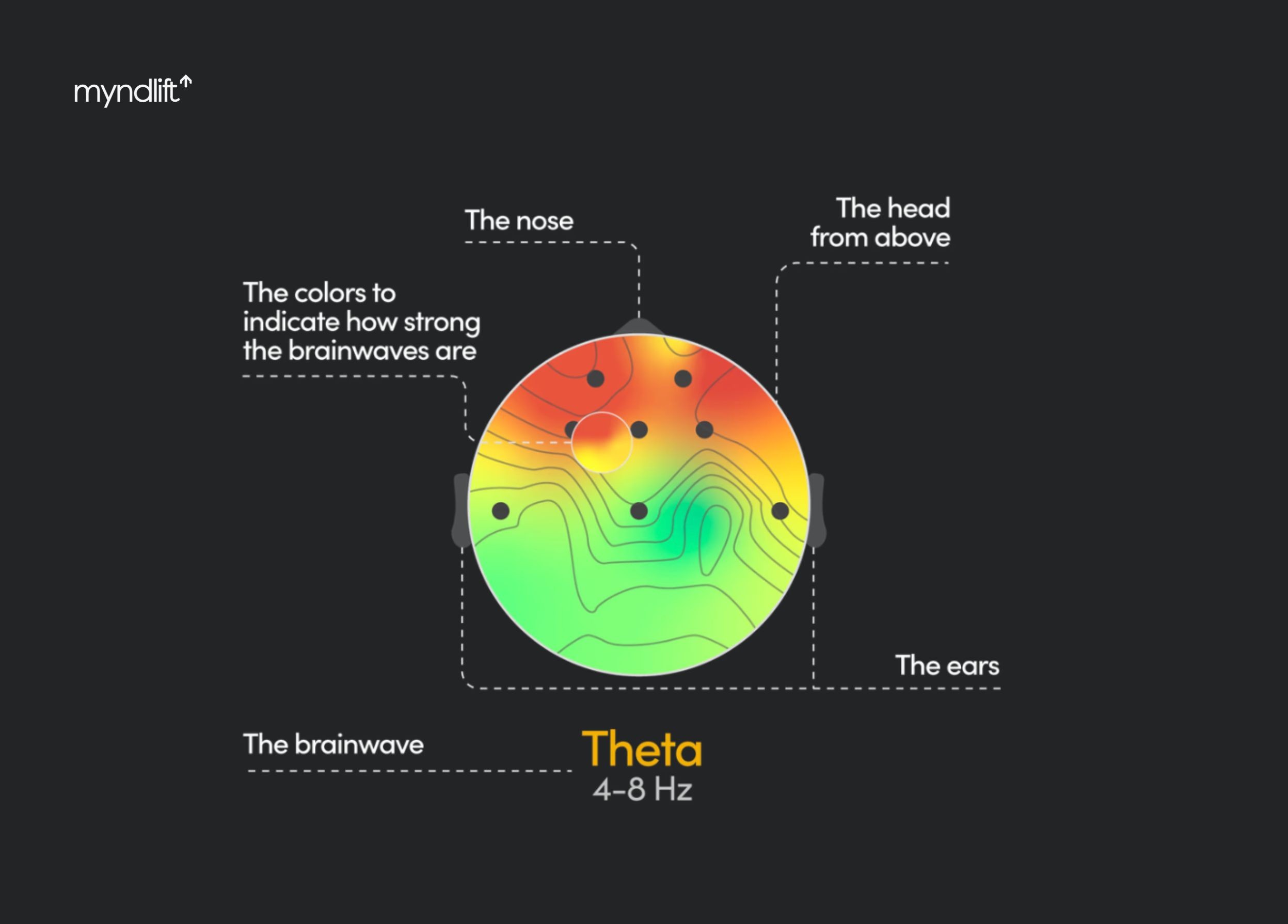 How to Read a qEEG Brain Map: A Practical Guide
