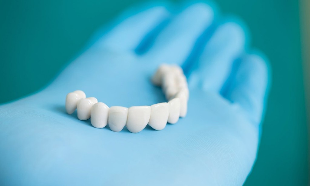 Tout savoir sur la prothèse dentaire fixe : guide complet - Dentusy
