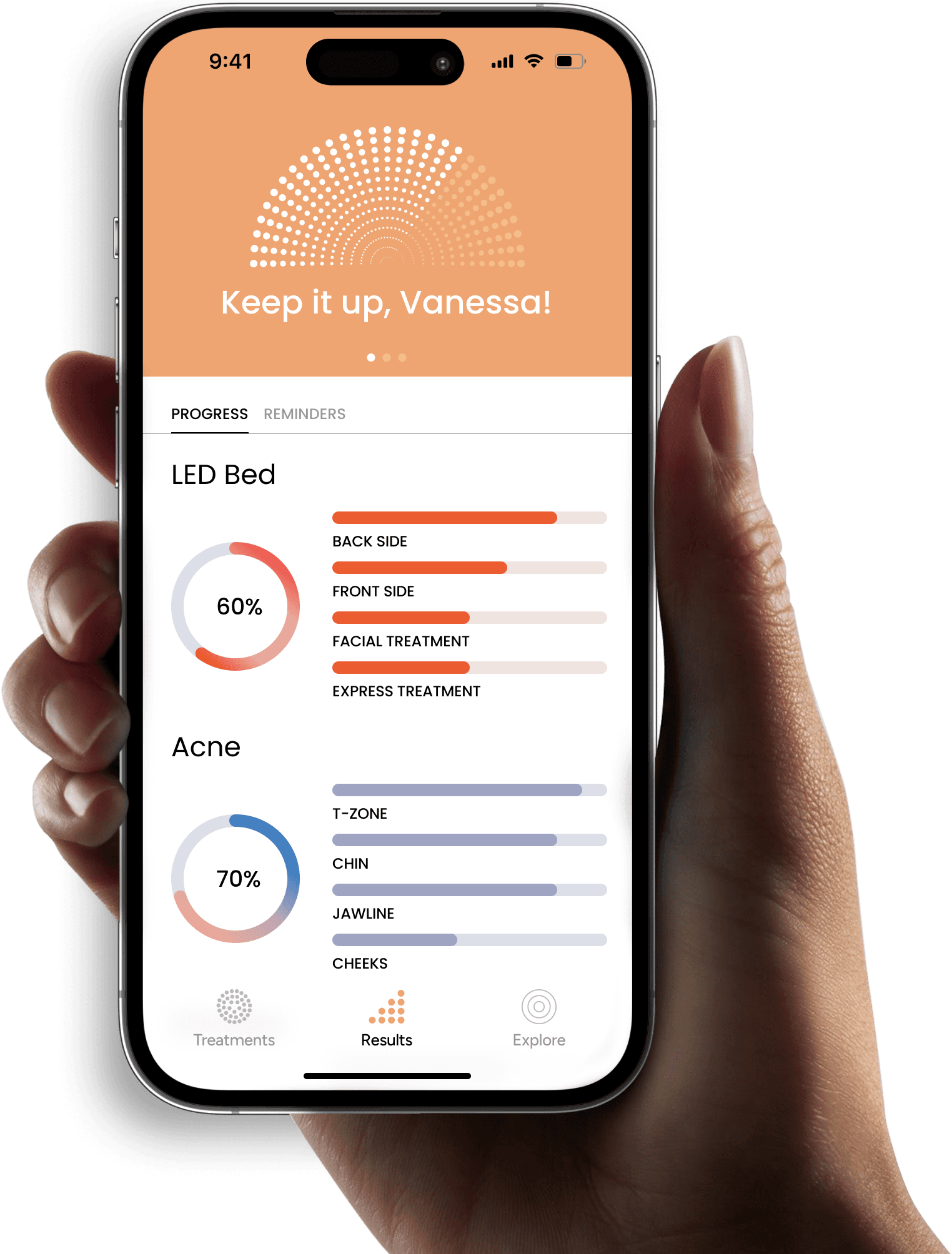 LightStim Case Study - Addison James