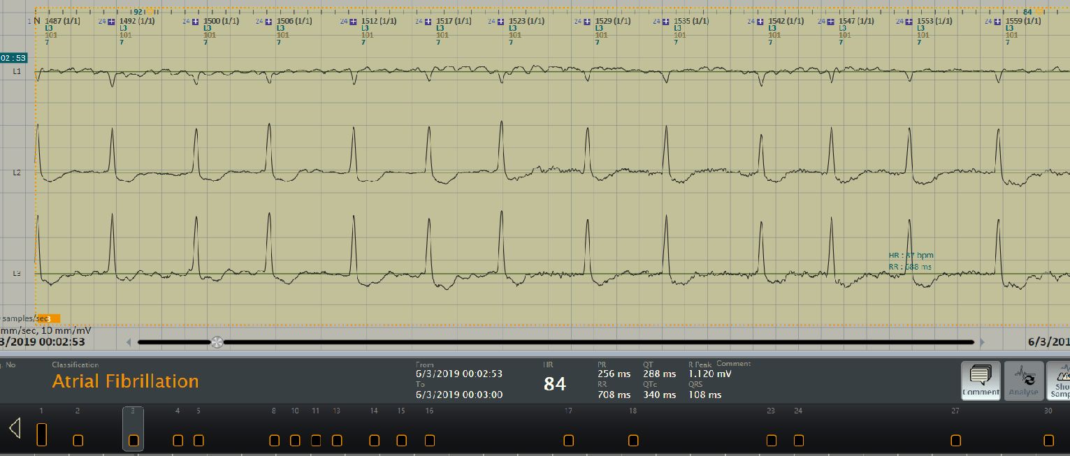 About Us | Cardiac Design Labs